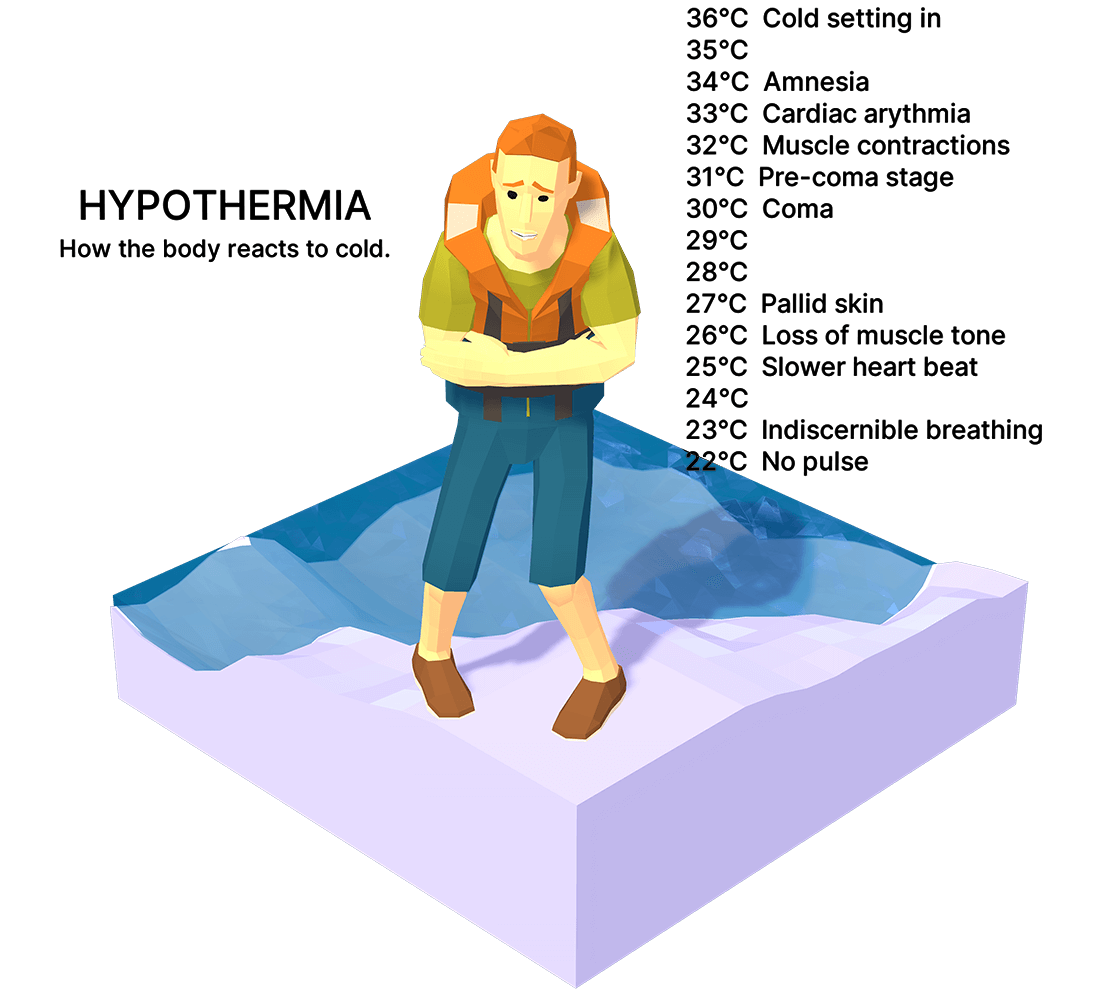 Hypothermia - Symptoms & Treatment